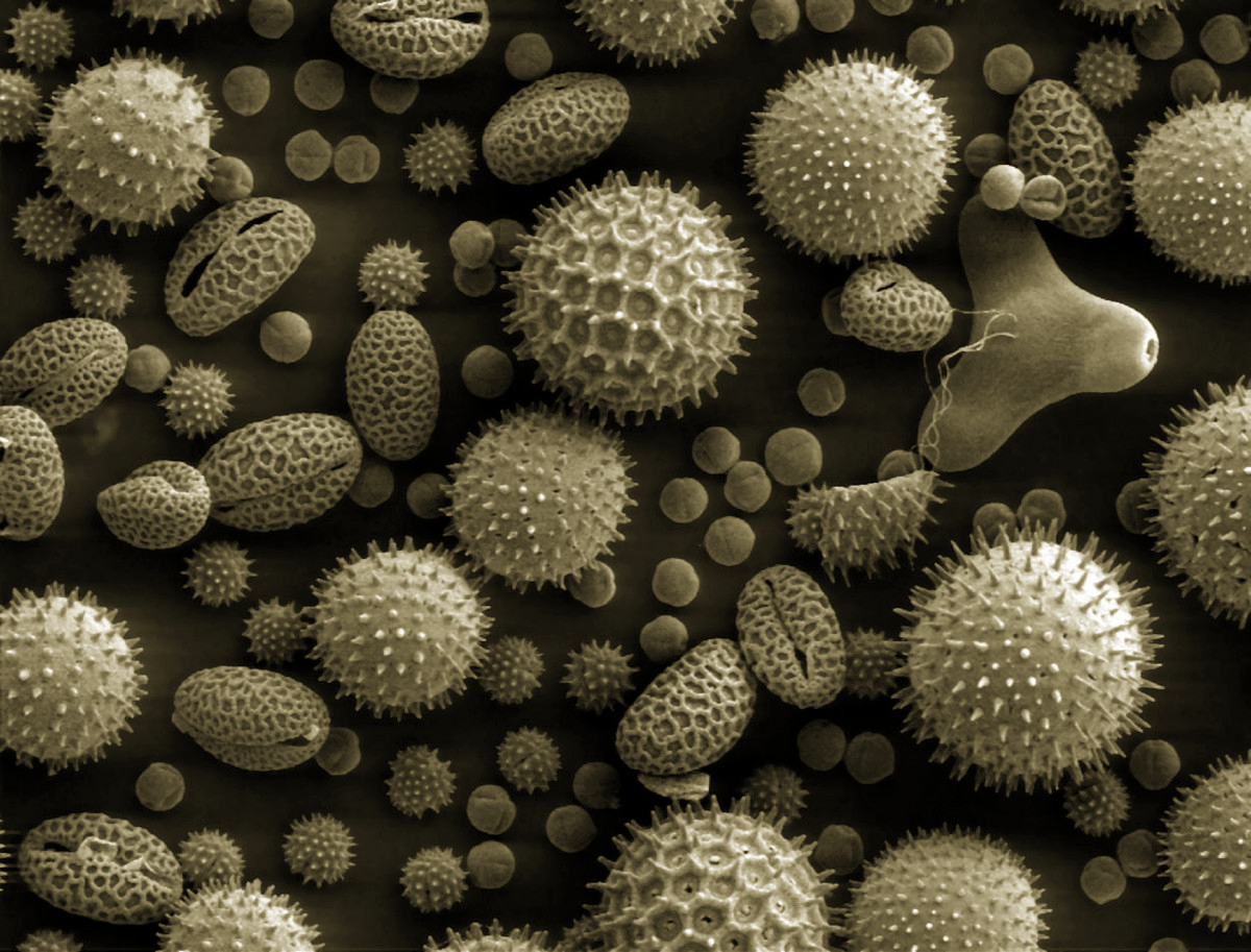 Une clef de détermination des grains de pollen interactive | Académie ...
